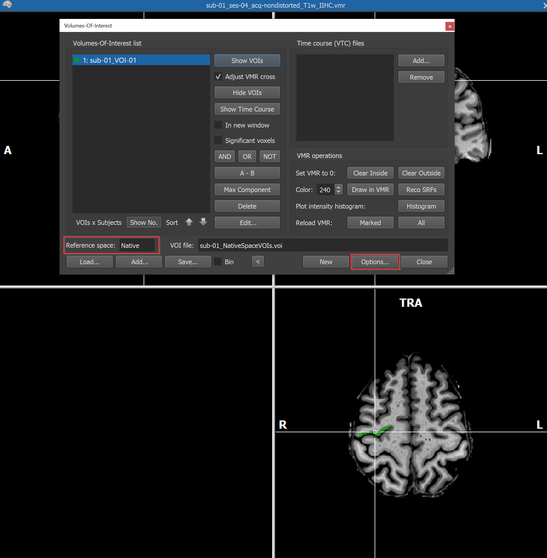 Spatial transformations of VOIs - to Native, ACPC, Talairach and MNI Space