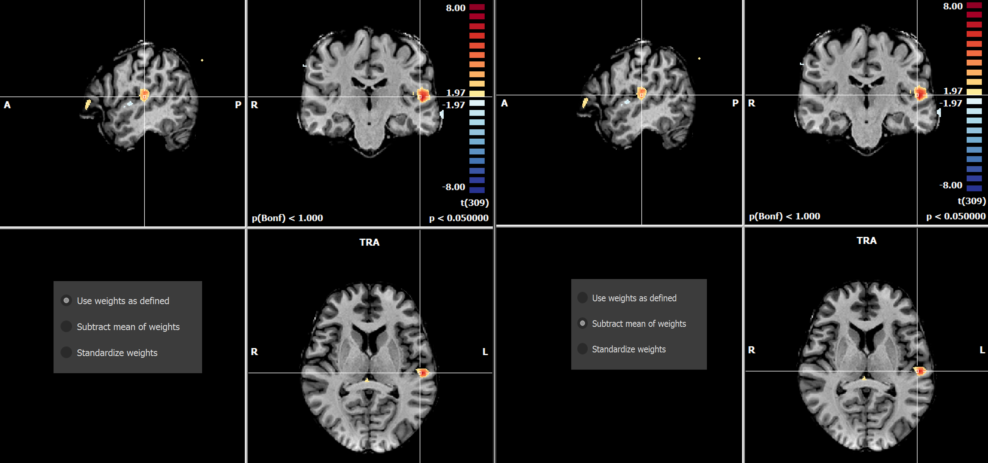 Glm And Parametric Modulation Of Predictors